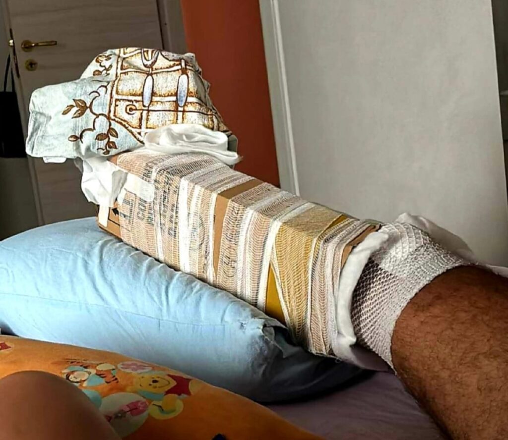 Malasanità, lo scandalo del cartone per una frattura: rimosso il ... Malasanità, lo scandalo del cartone per una frattura: rimosso il ...